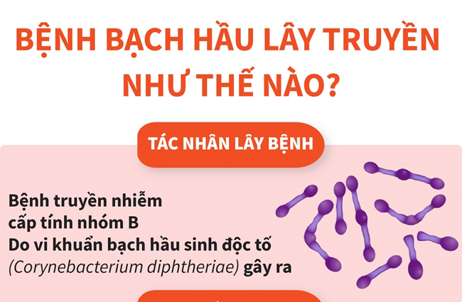Bệnh bạch hầu lây truyền như thế nào? | baotintuc.vn