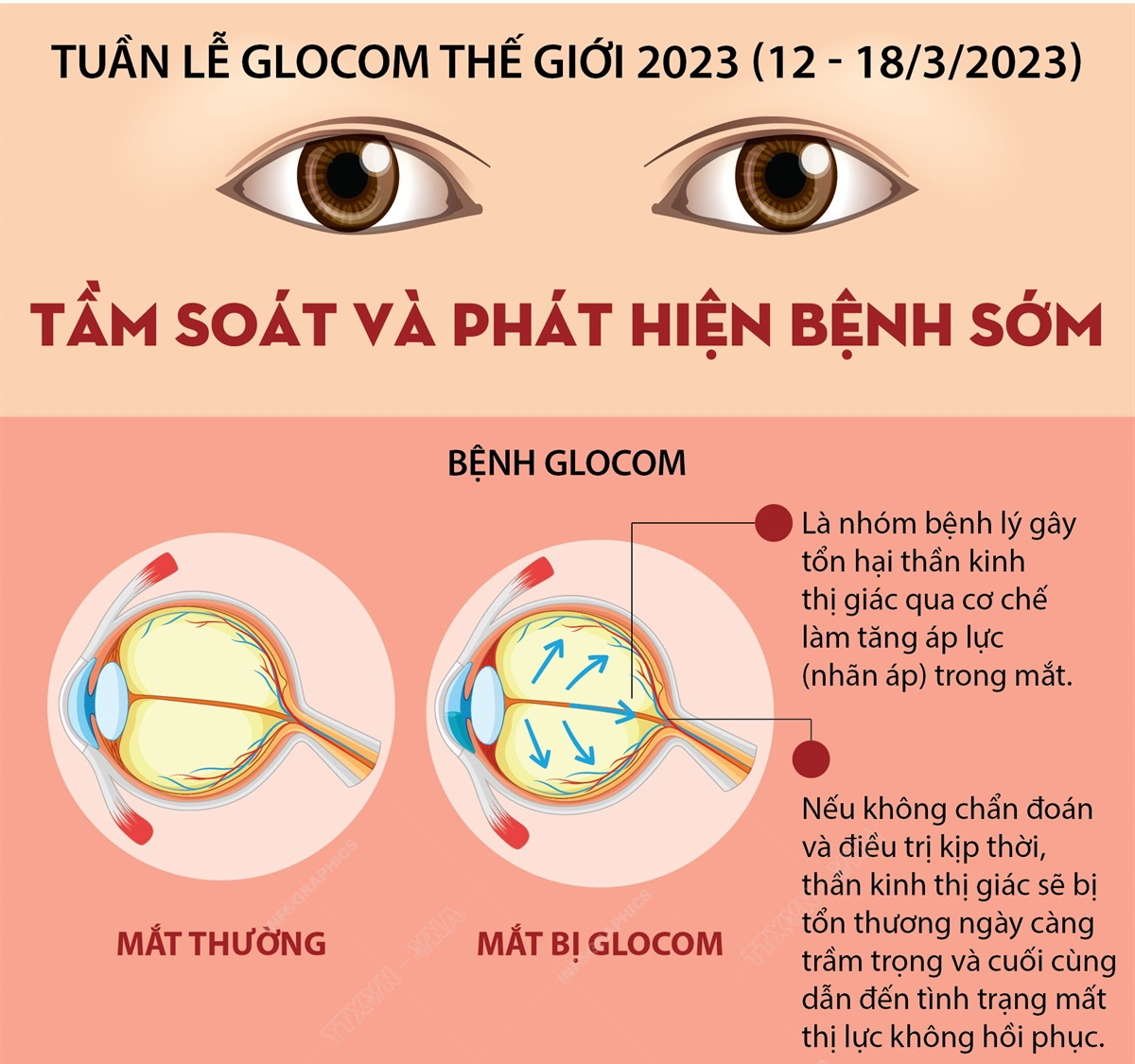 Tuần lễ Glocom Thế giới 2023 (12 - 18/3/2023): Tầm soát và phát hiện ...