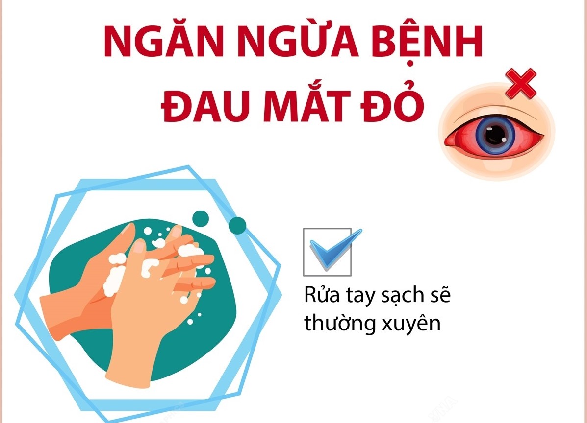 Ngăn ngừa bệnh đau mắt đỏ | baotintuc.vn